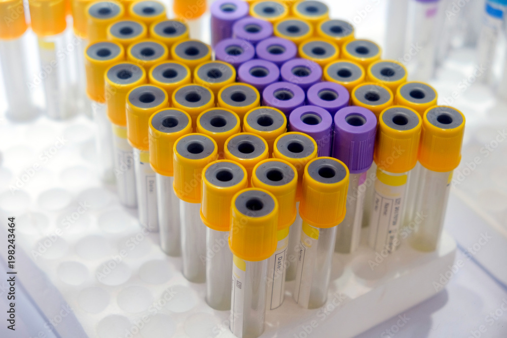 Selective focus a group of medical sample tube yellow and purple color ...