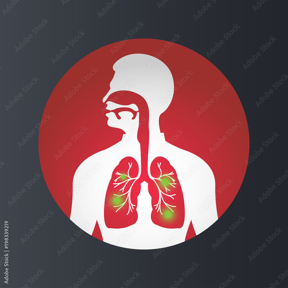 TUBERCULOSIS vector logo icon illustration Stock Vector | Adobe Stock