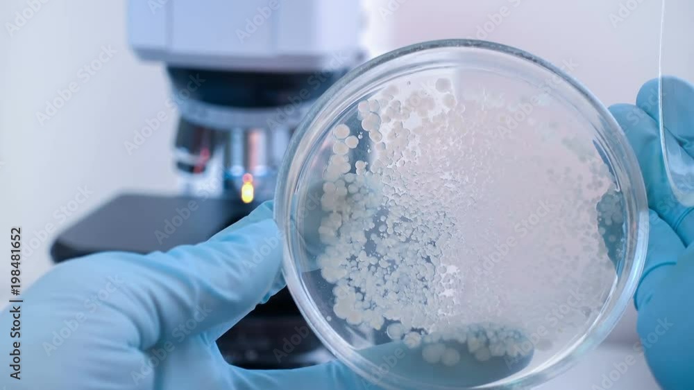 Close-up the appearance of a Petri dish in front of a microscope ...