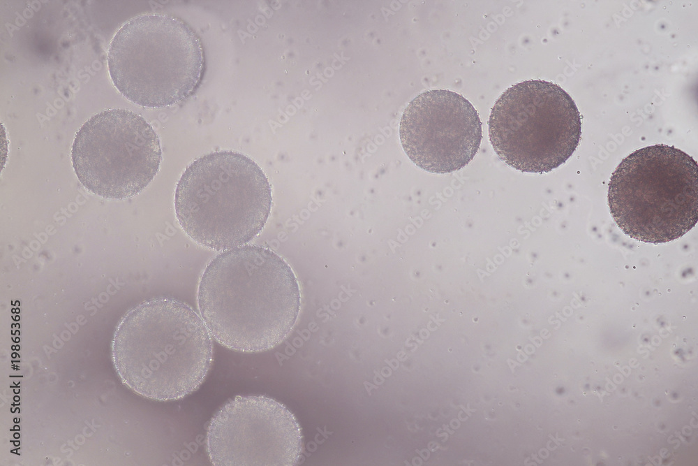 pollen under microscope - 600x Stock Photo | Adobe Stock