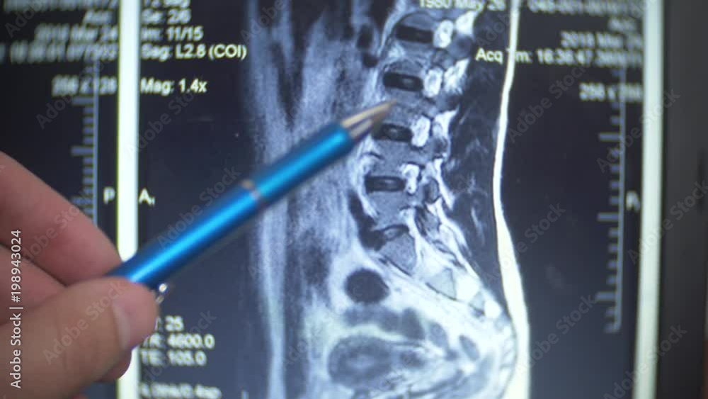 Close. MRI X-ray images. results of magneto resonance therapy on the ...