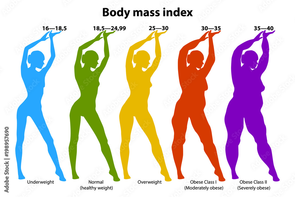 Body mass index (BMI). Vector medical infographic. Stock Vector | Adobe ...