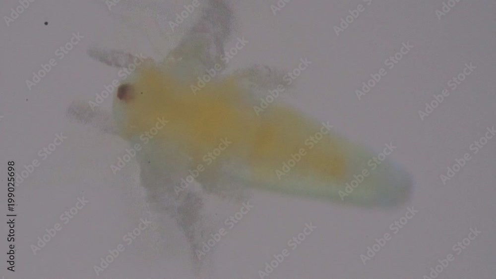 Baby of brine shrimp under microscope. The microscopic world. Stock ...