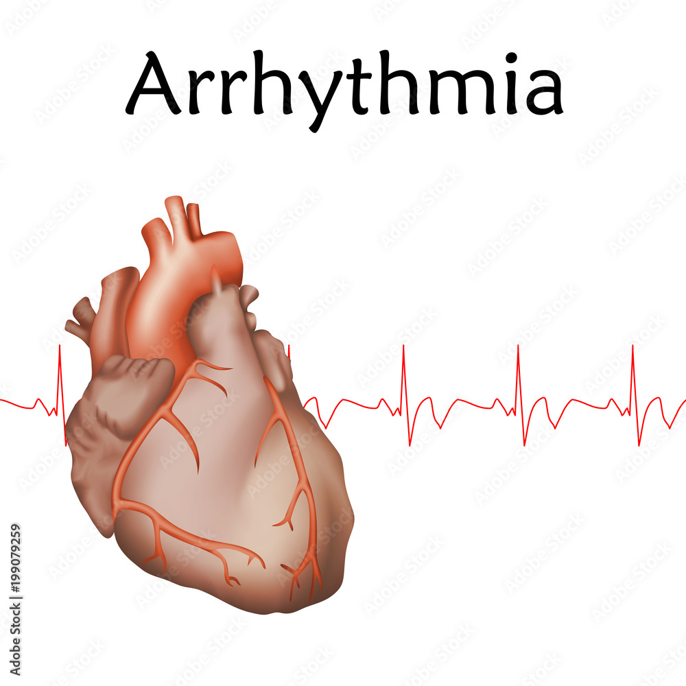 Human heart. Arrhythmia. Anatomy illustration. Red image, white ...
