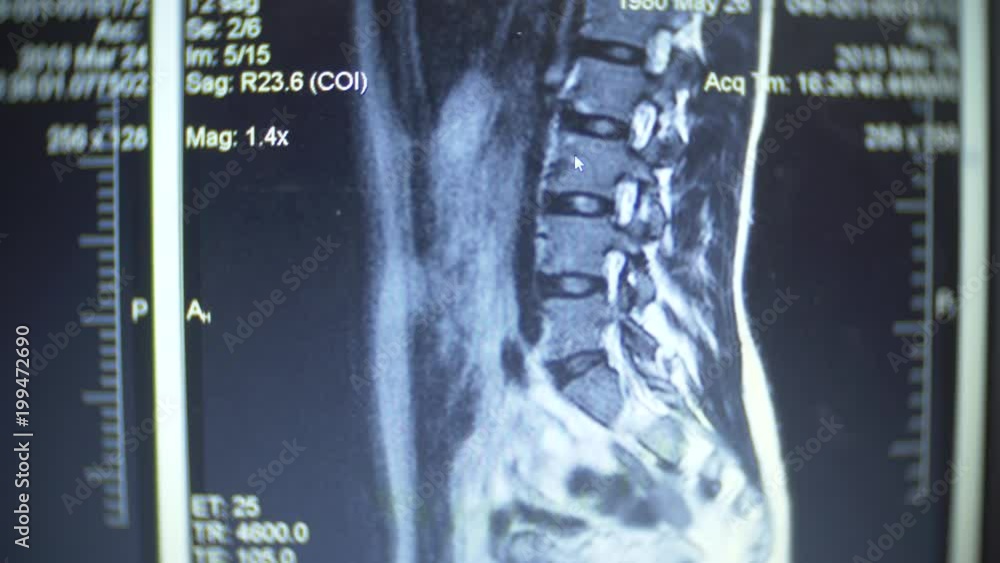 Close. MRI X-ray images. results of magneto resonance therapy on the ...