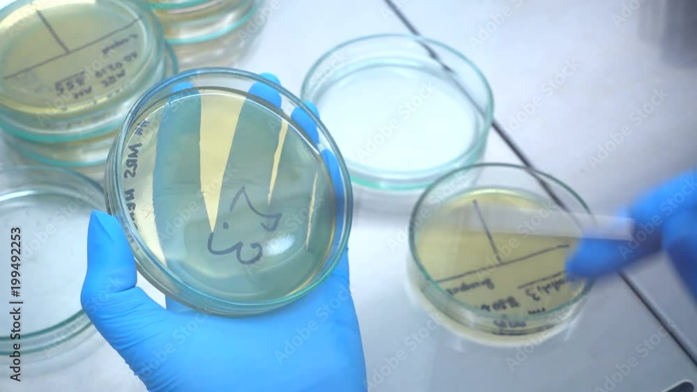 Sowing bacteria on a petri dish using a microbiological loop ...