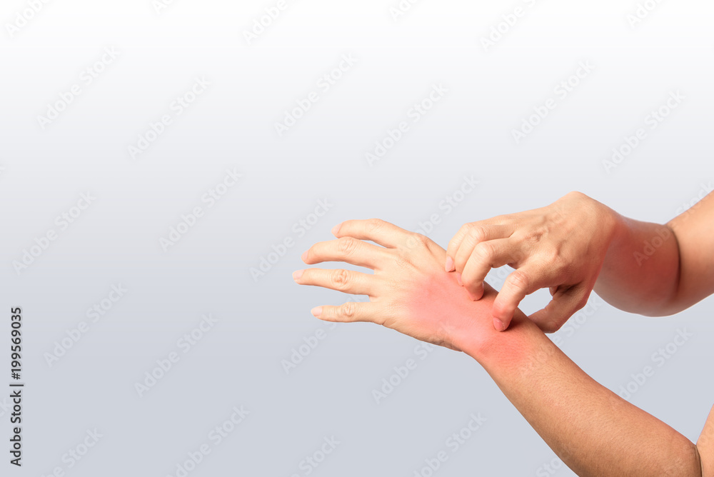 right hand scratching left wrist joint, rash at left wrist joint of ...