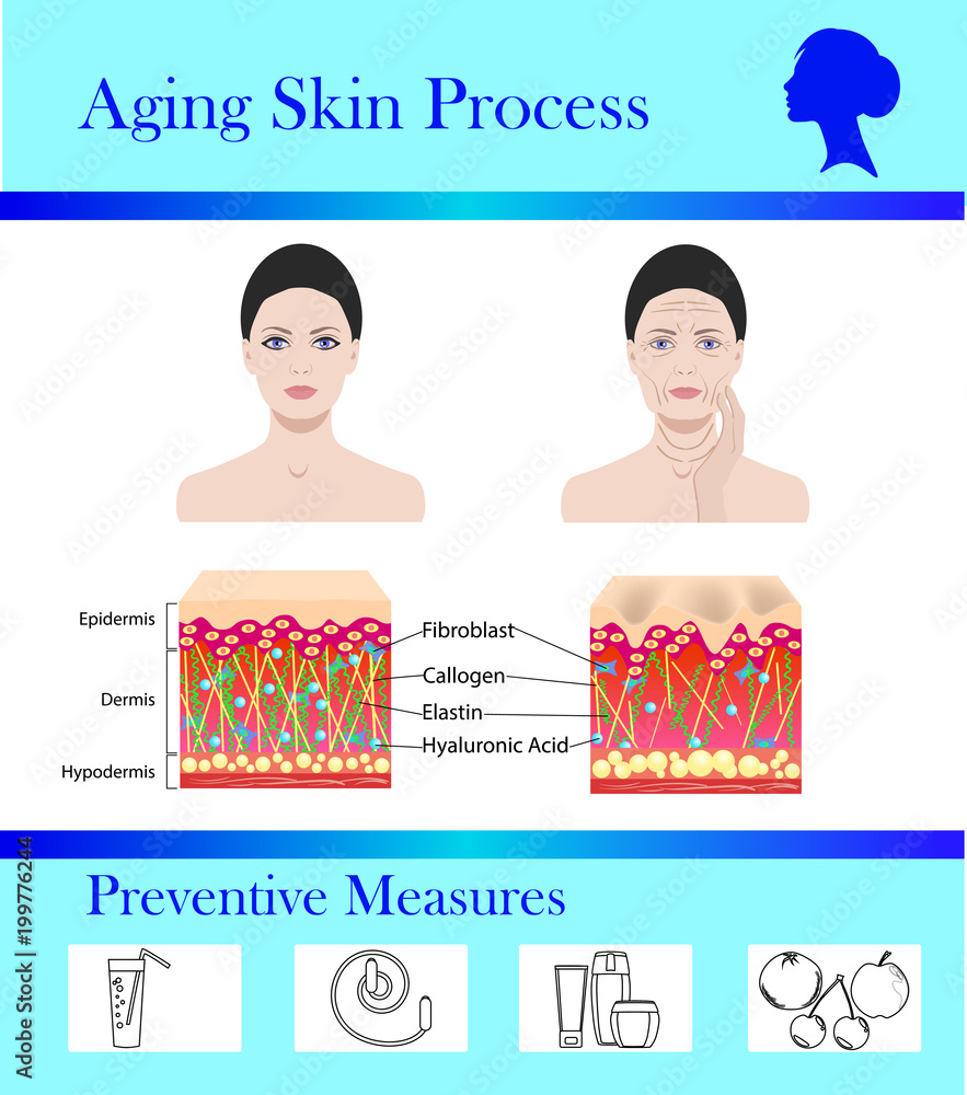 Aging skin process and preventive tipps, vector illustration Stock ...