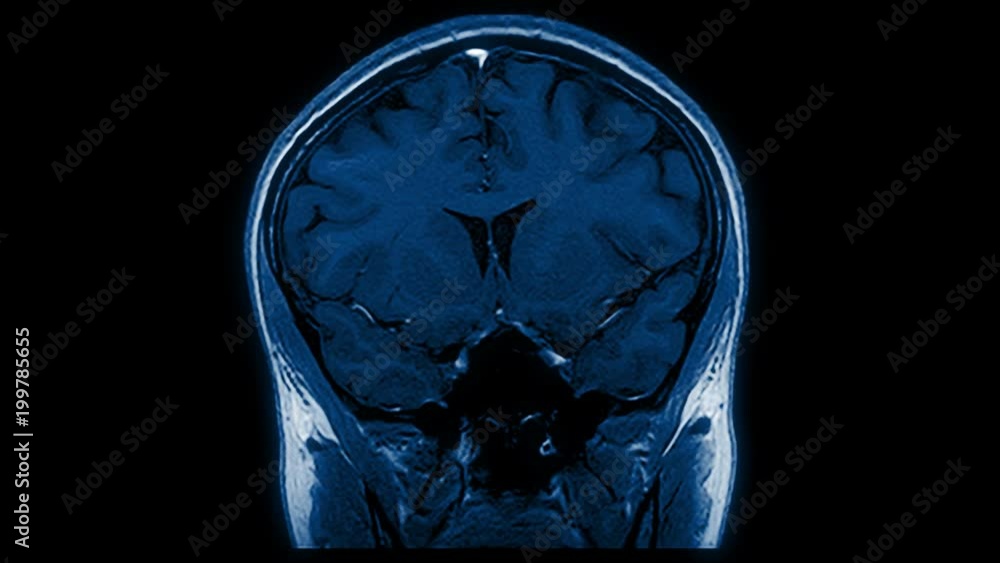 Computed medical tomography MRI upscaled scan of healthy young female ...