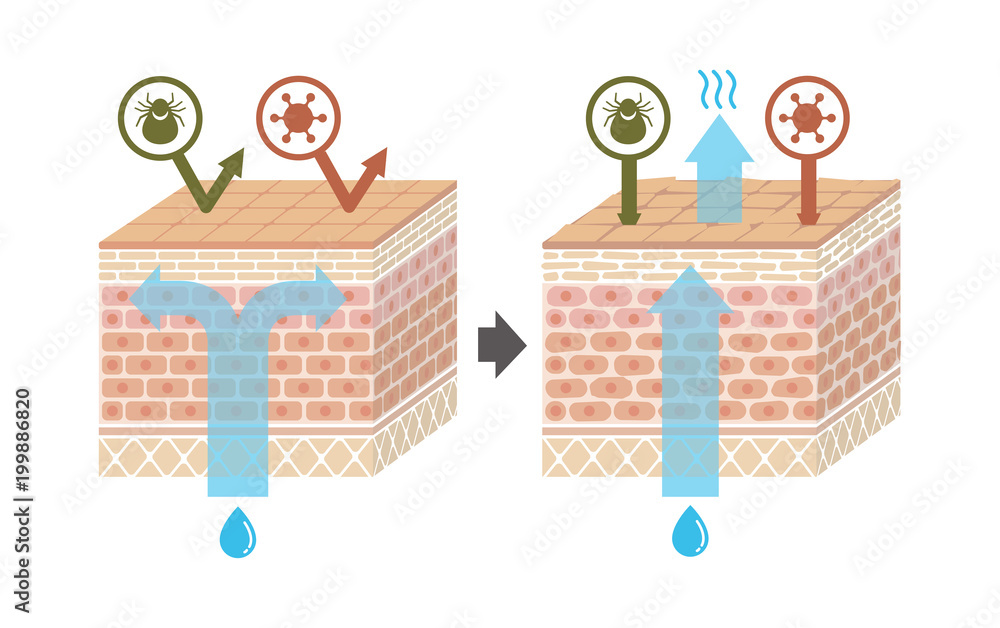 Sectional view of the skin.Comparison illustration of protection effect ...