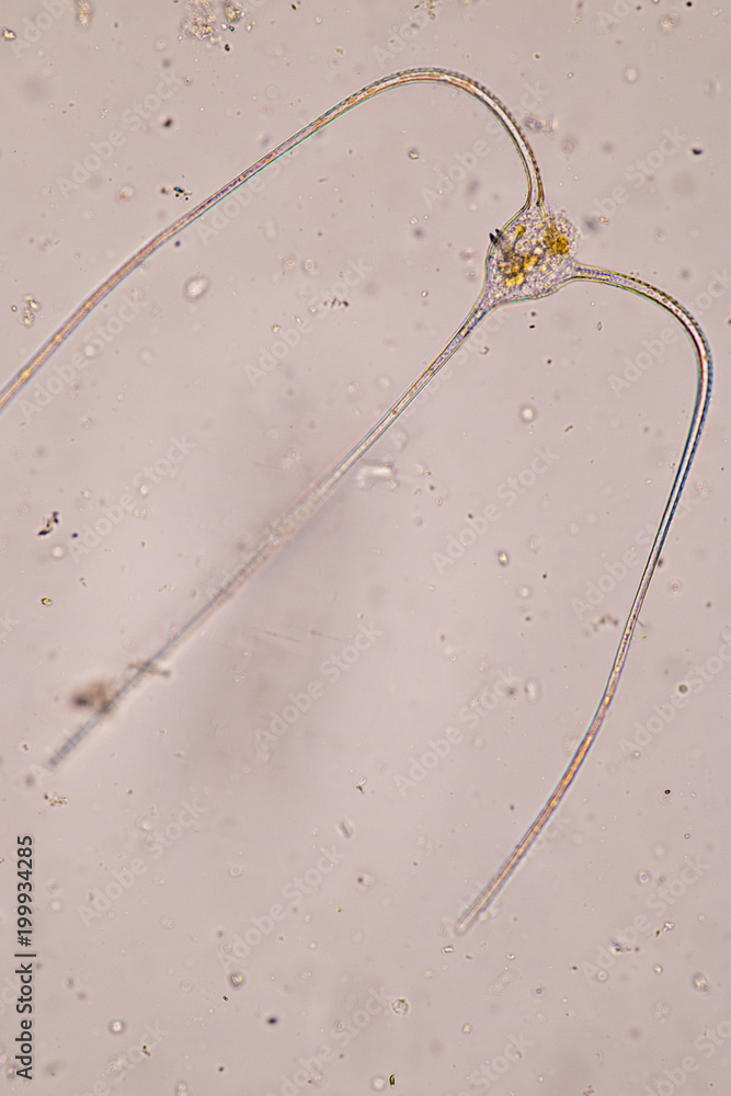 Ceratium Under Microscope