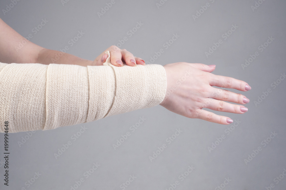 Fractures and dislocations concept. Female hand in a white bandage. A ...