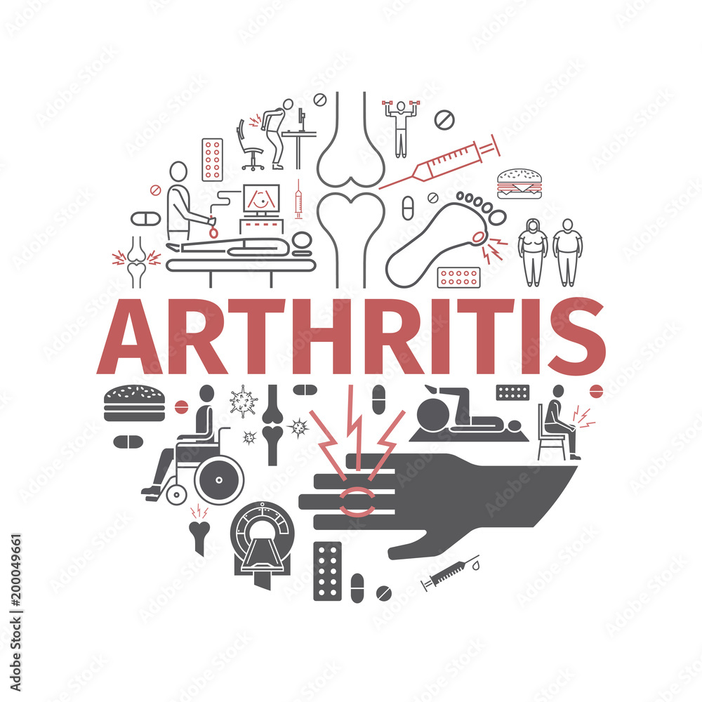 Arthritis round banner. Symptoms, Treatment. Line icons set. Vector ...