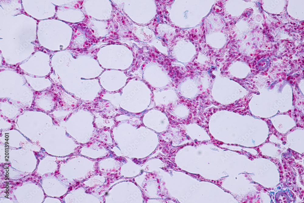 Human lung tissue under microscope view for education histology. Stock ...