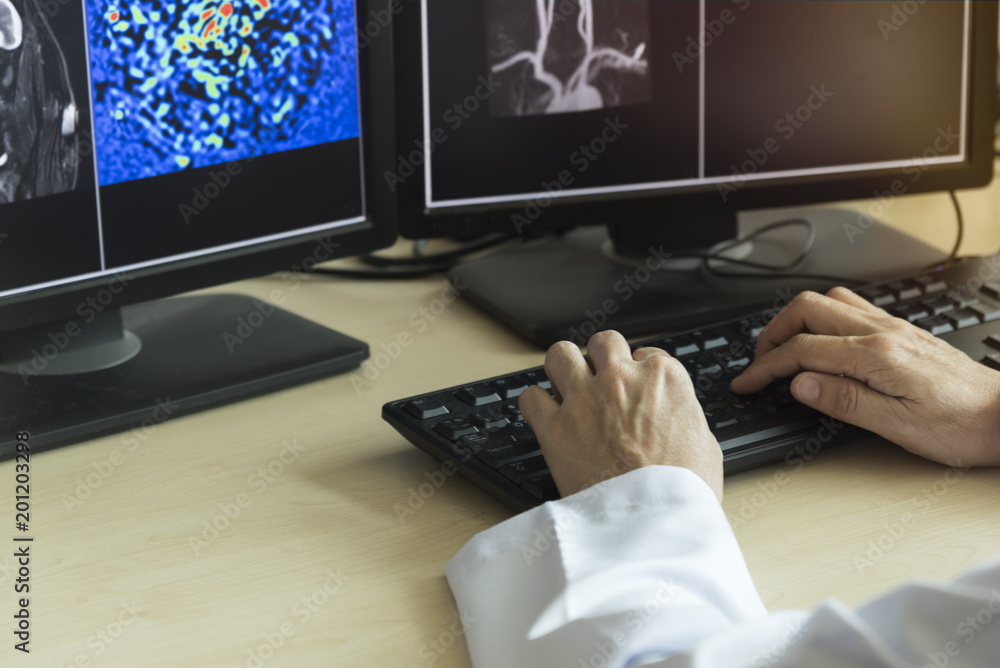 Doctor using computer to look MRI in monitor Stock Photo | Adobe Stock