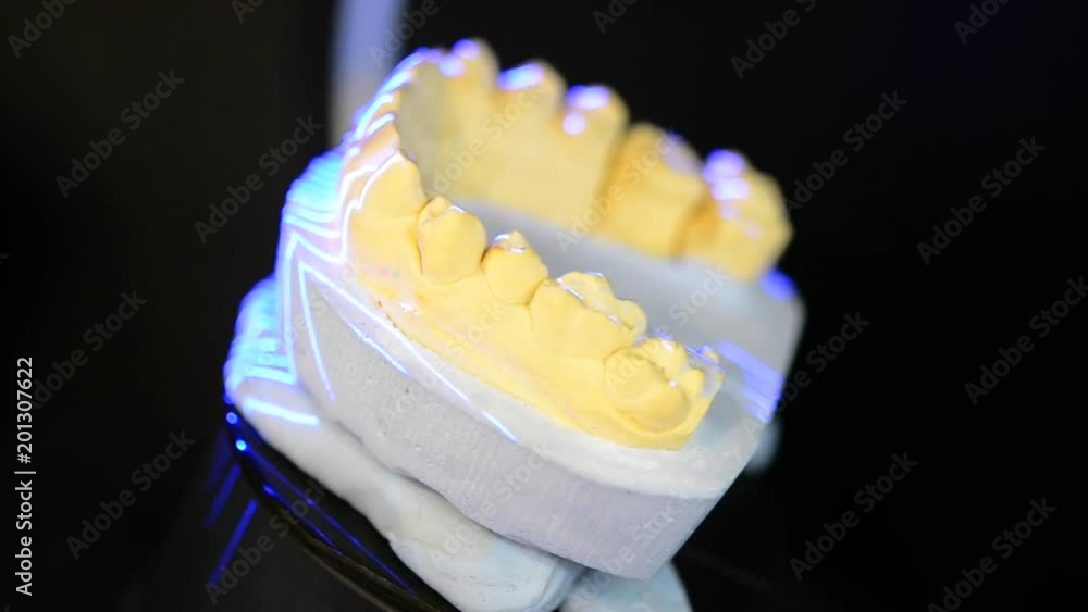 3D Scanning a model of human teeth from gypsum close-up. Creation 3D ...