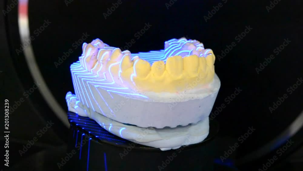 3D Scanning a model of human teeth from gypsum close-up. Creation 3D ...