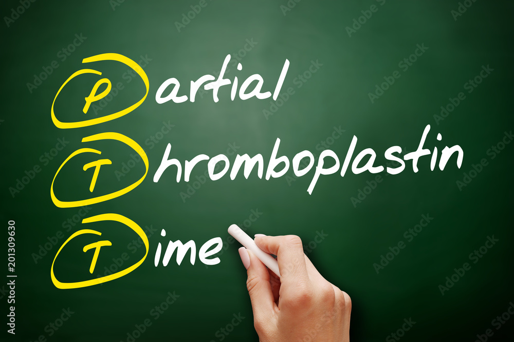 PTT - Partial Thromboplastin Time acronym, concept on blackboard Stock ...