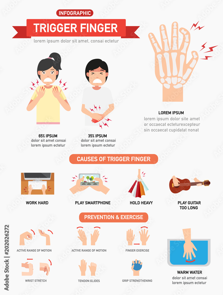 Trigger finger infographic,vector illustration Stock Vector | Adobe Stock