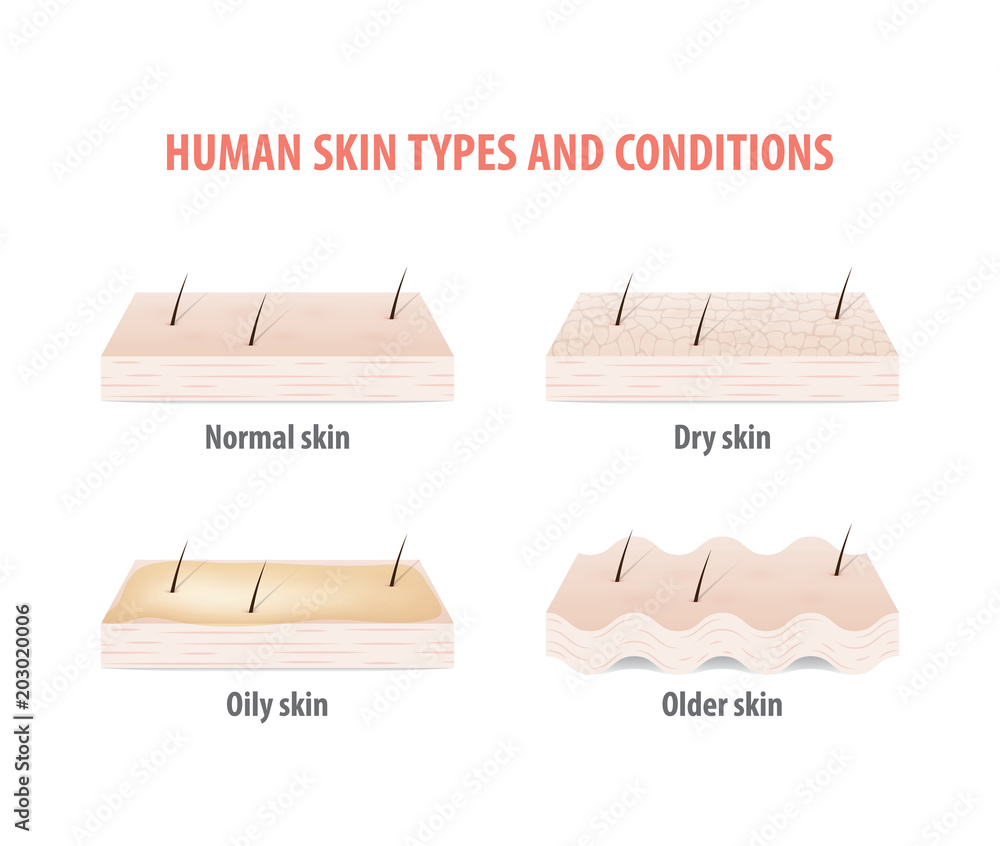 Human skin types and conditions illustration vector on white background ...