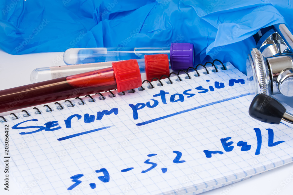 Potassium in serum or blood in basic metabolic test. Laboratory test ...