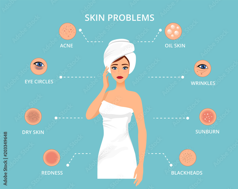 The most common female facial skin problems: acne, wrinkles, dry skin ... The most common female facial skin problems: acne, wrinkles, dry skin ...