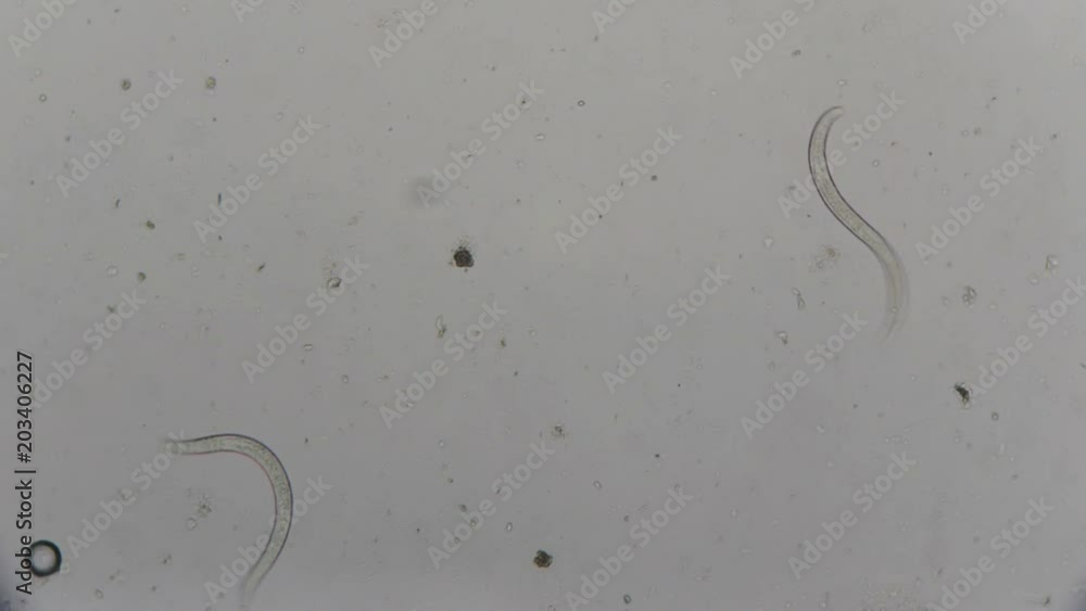 parasite : Strongyloides stercoralis from human feces under microscope ...