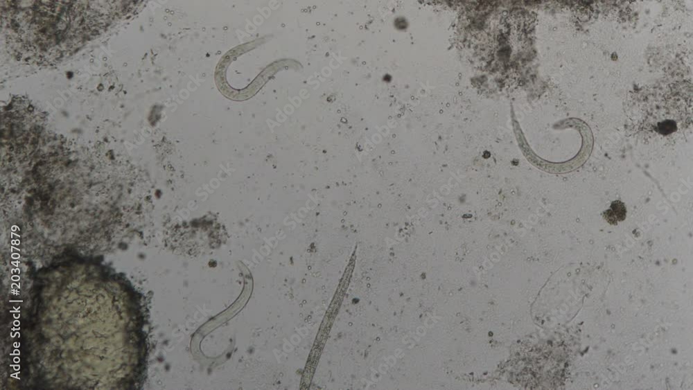 Stockvideon parasite : Strongyloides stercoralis from human feces under ...