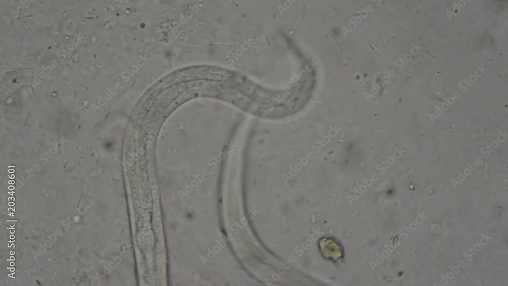 parasite : Strongyloides stercoralis from human feces under microscope ...