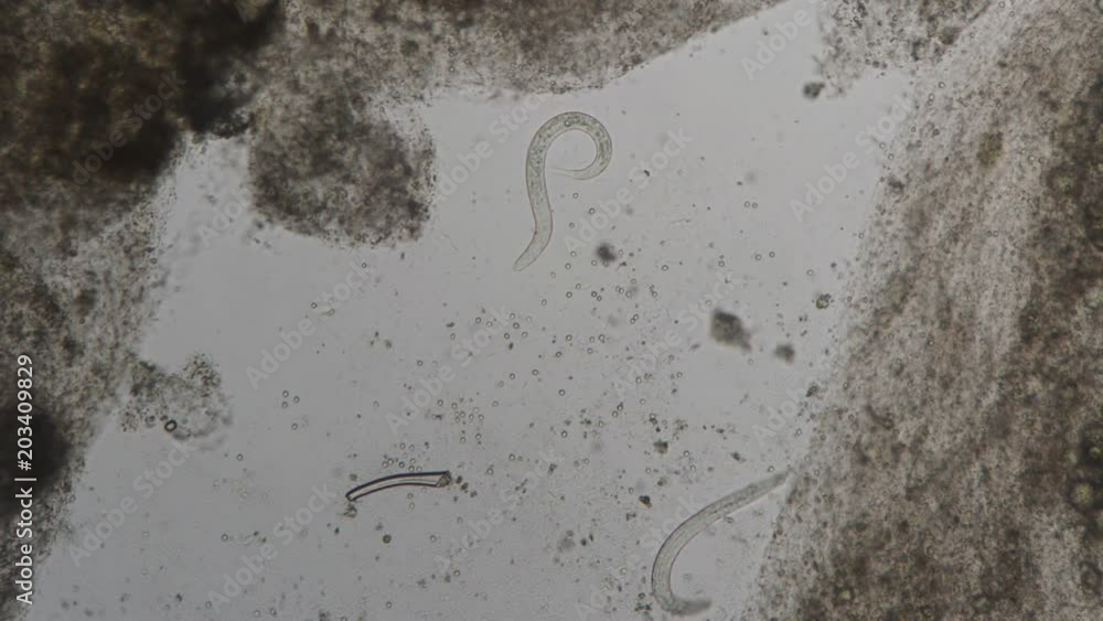 parasite : Strongyloides stercoralis from human feces under microscope ...