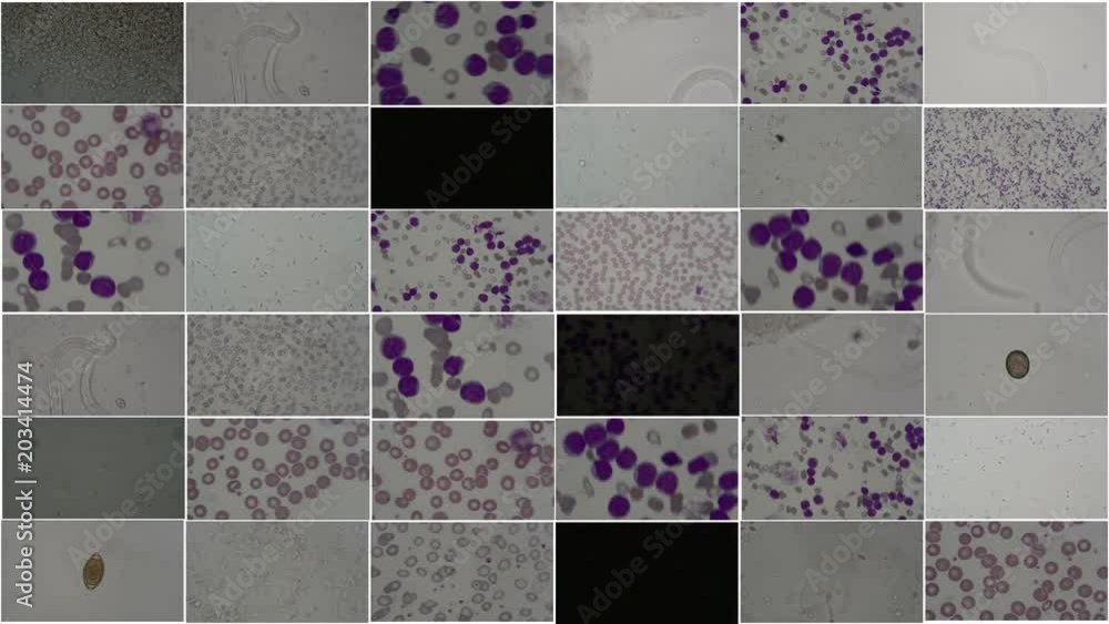 human blood smear , parasite , blood cells under microscope , for ...
