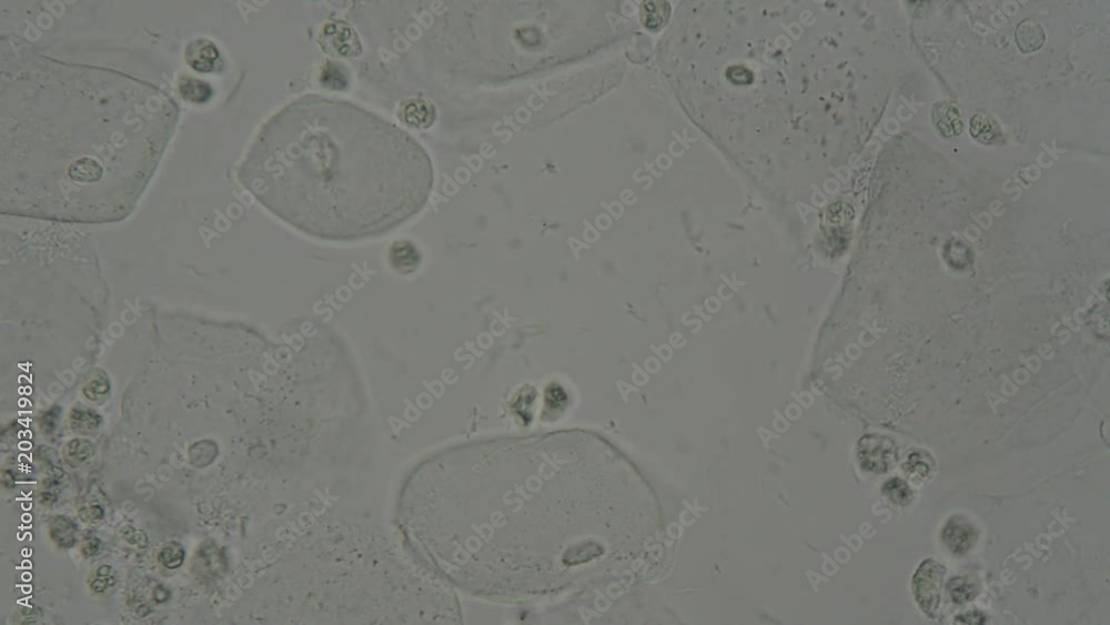 wet smear from vagina swab show epithelium cell , white blood cell and ...