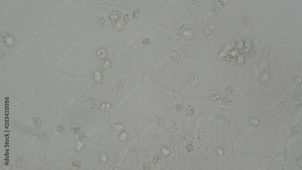 wet smear from vagina swab show epithelium cell , white blood cell and ...
