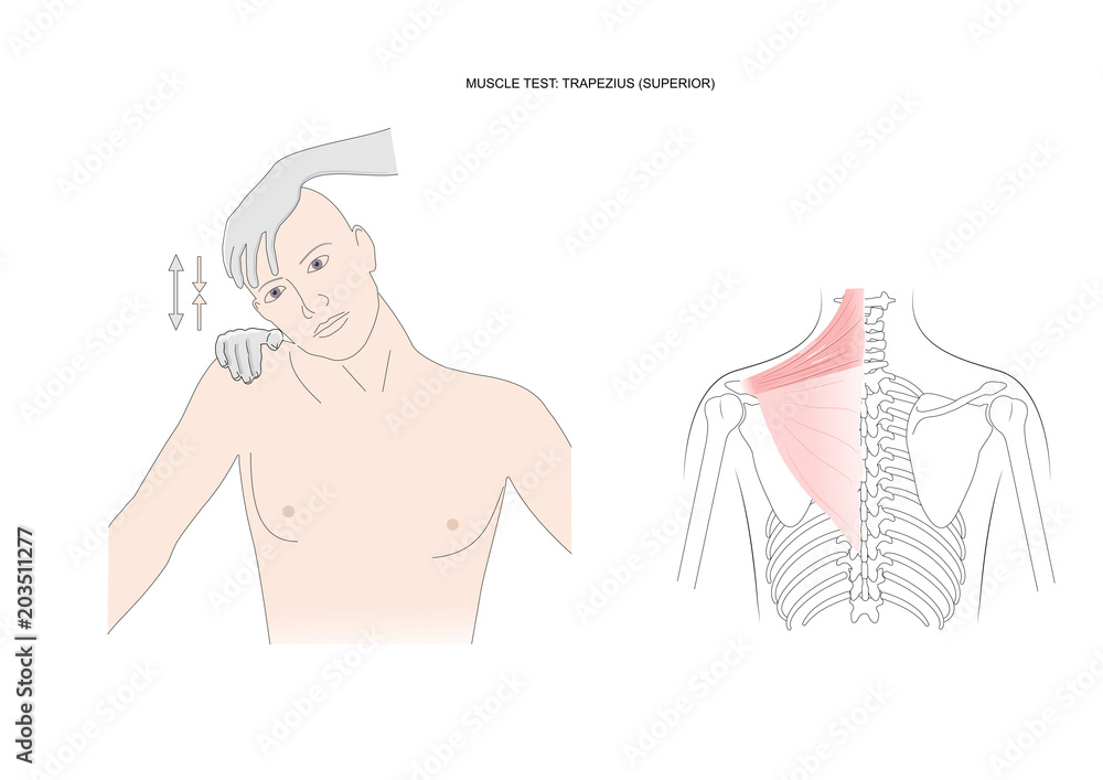 muscle testing: trapezius (superior portion). Test used in kinesiology ...
