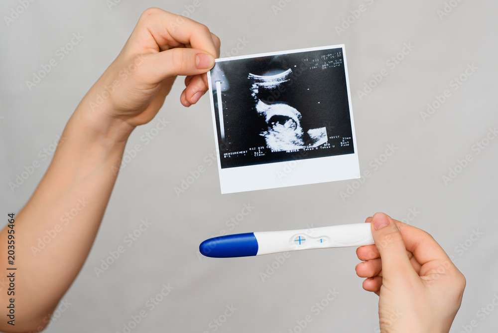 ultrasound picture and positive pregnancy test in the hands of a girl ...