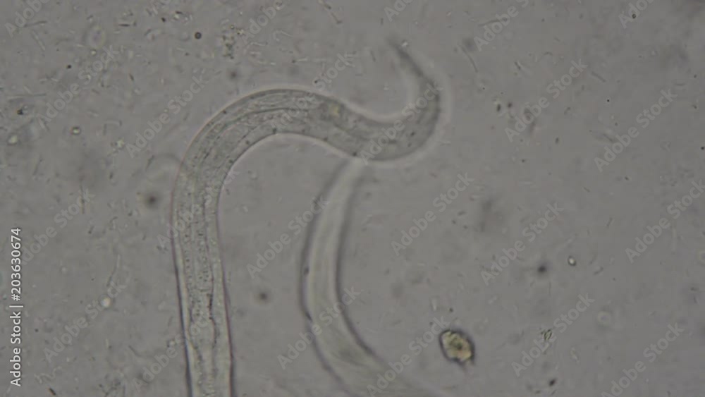 parasite : Strongyloides stercoralis from human feces under microscope ...