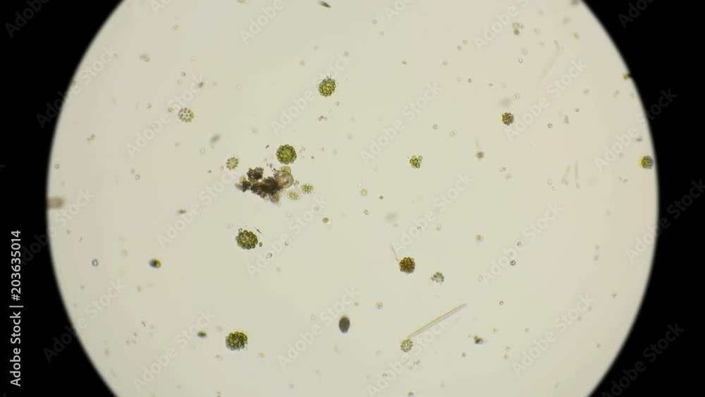 Eudorina Under Microscope