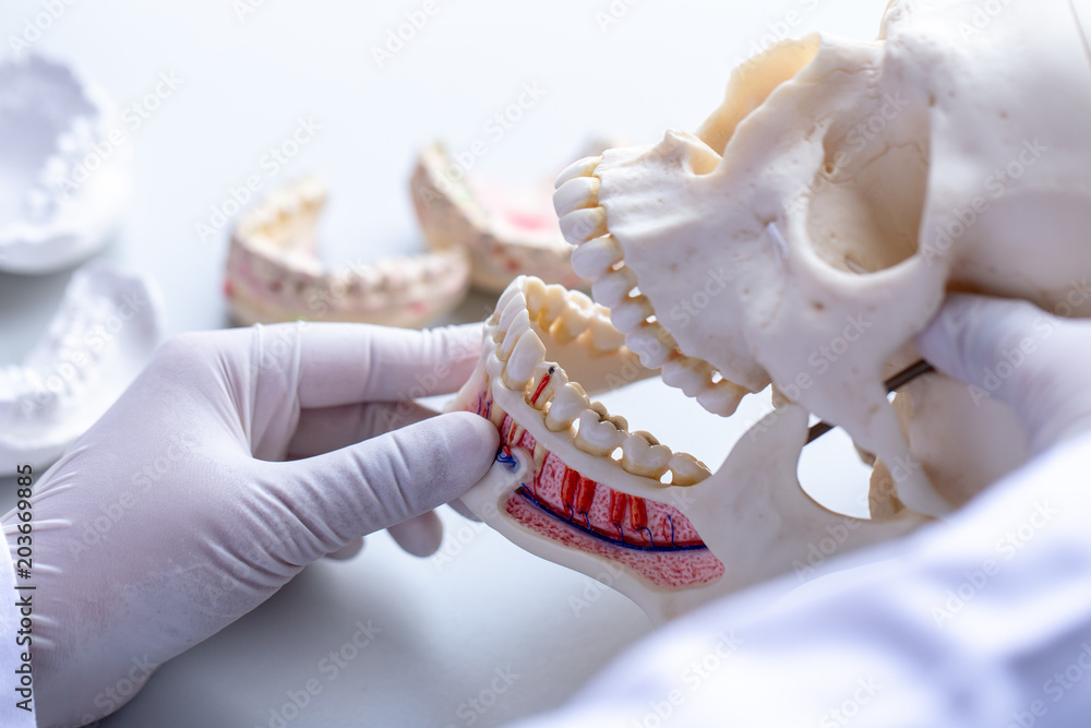 Study cast of Diagnostic cast and dental gypsum models in dental ...