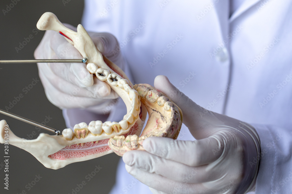Study cast of Diagnostic cast and dental gypsum models in dental ...