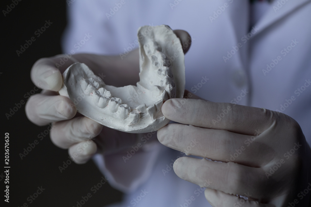 Study cast of Diagnostic cast and dental gypsum models in dental laboratory. foto de Stock ...