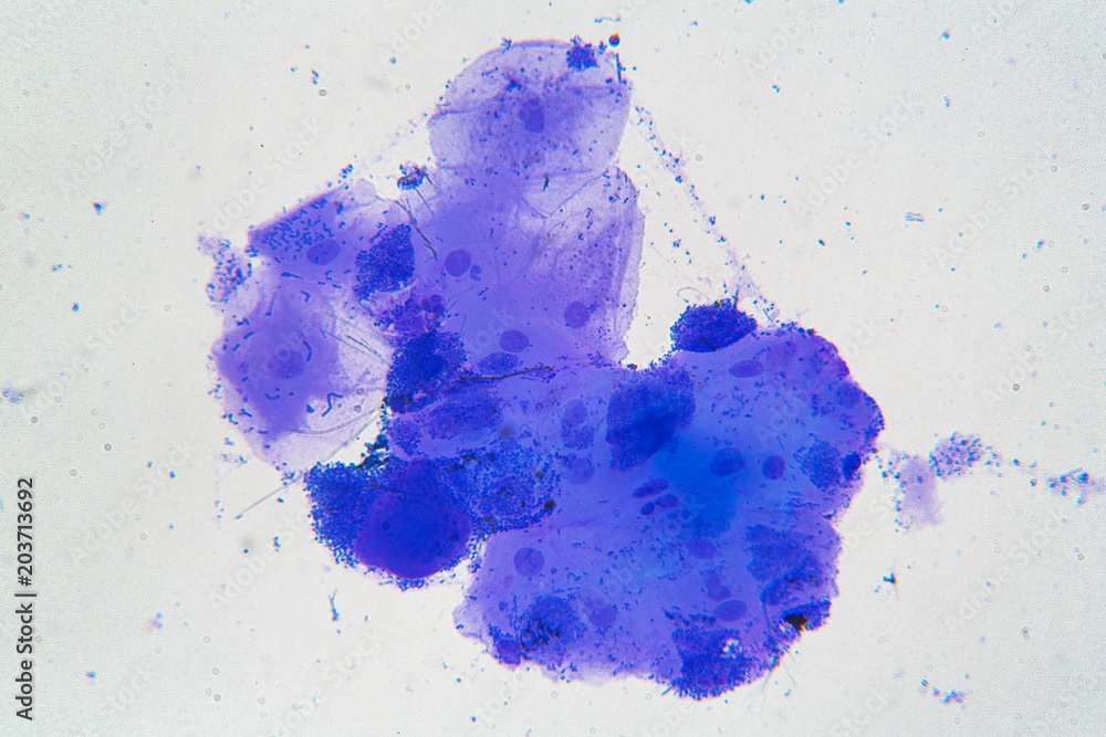 Poster Buccal mucosa cells and bacteria colored with methylene blue ...