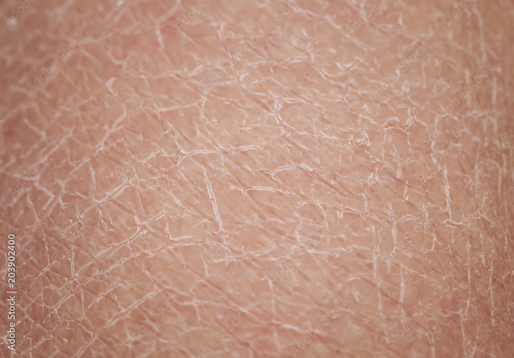 White Human Skin Texture