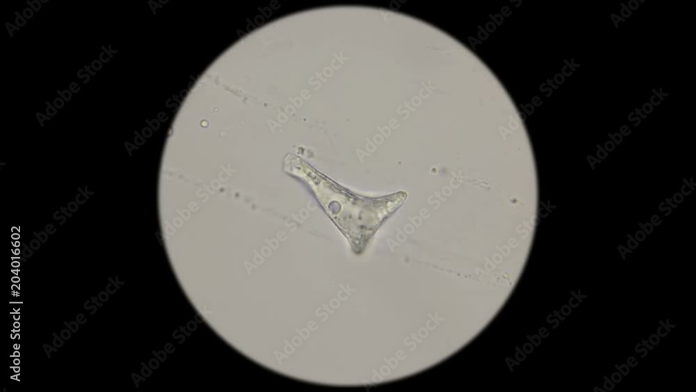 basal cell of the nasal mucosa under a microscope vídeo de Stock ...