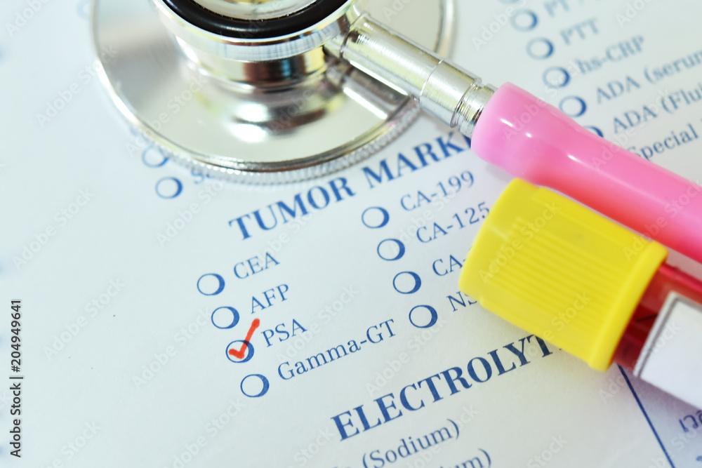 Blood sample with lab requisition form for PSA test, prostate cancer ...
