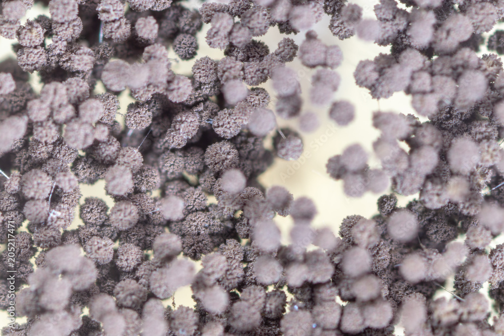 Rhizopus (bread mold) is a genus of common saprophytic fungi,Rhizopus ...