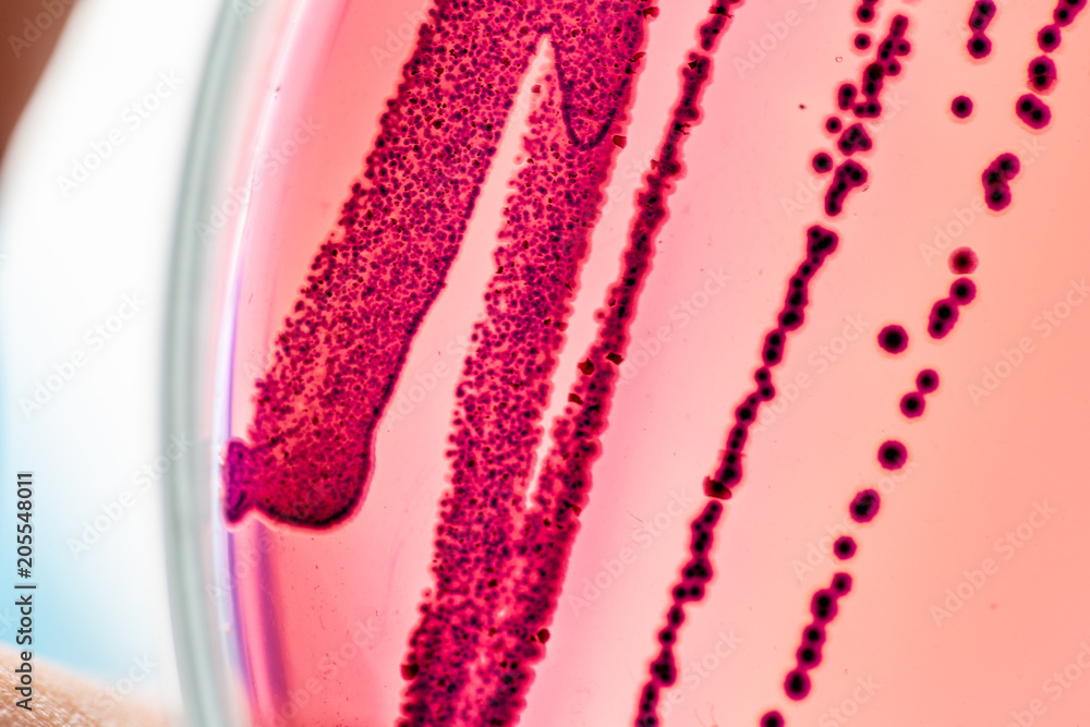 Colony Characteristics of Escherichia coli (E. coli) is a Gram-negative ...
