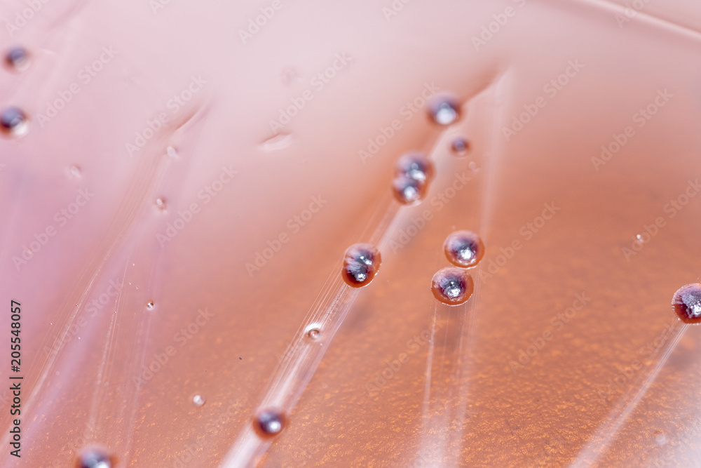 Colony Characteristics of Escherichia coli (E. coli) is a Gram-negative ...