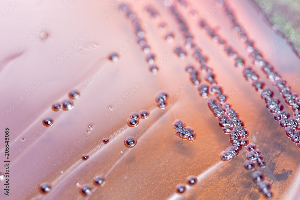 Colony Characteristics of Escherichia coli (E. coli) is a Gram-negative ...