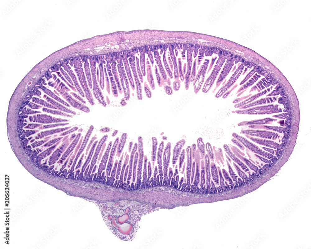 Small intestine. Intestinal villi Stock Photo | Adobe Stock
