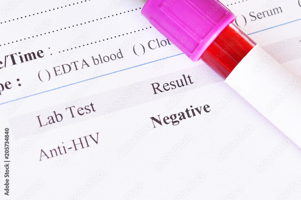 HIV negative test result with blood sample tube Stock Photo | Adobe Stock